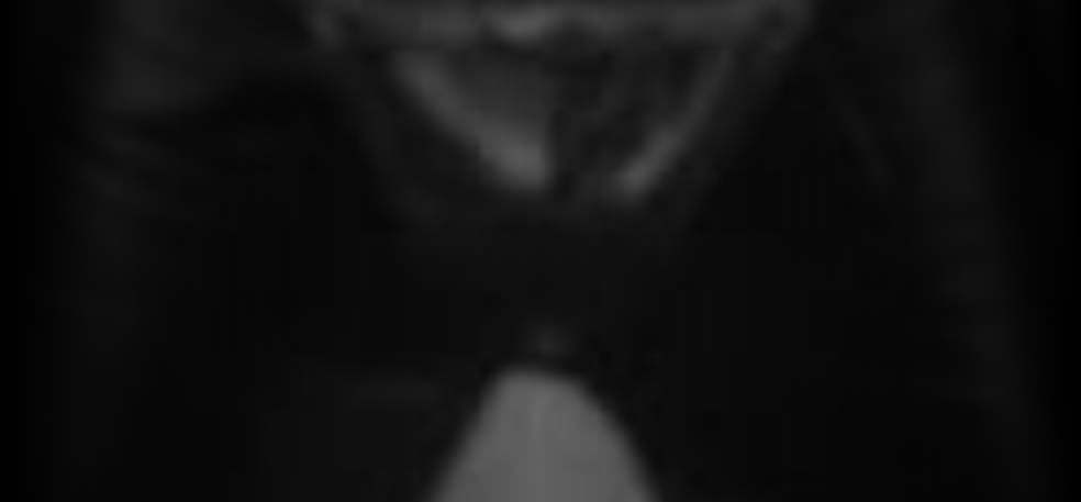 Mapplethorpe Nude Scenes Naked Pics And Videos At Mr Skin